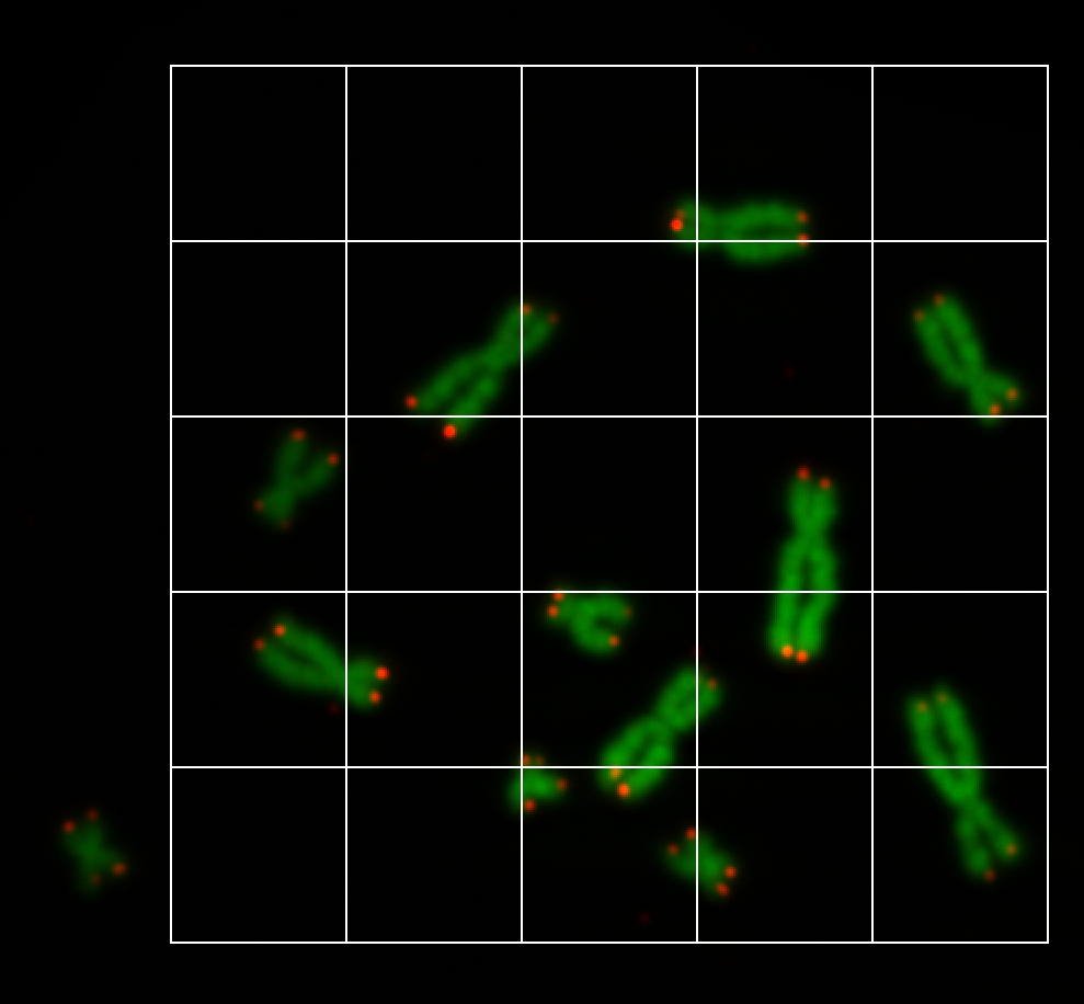 The QFISH Application: Telomere Length Measurement with Machine ...