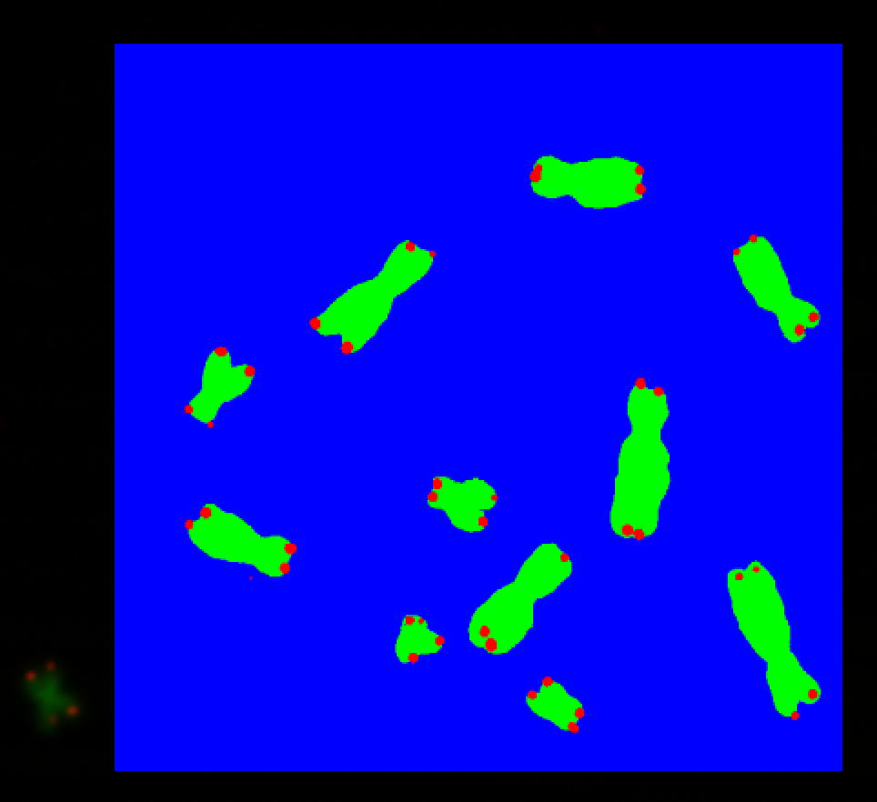The QFISH Application: Telomere Length Measurement with Machine ...
