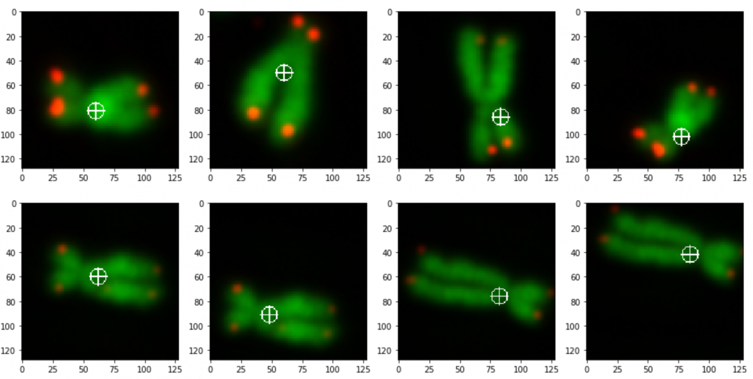 Centromere Position on a Chromosome Image using a Neural Network - Real ...